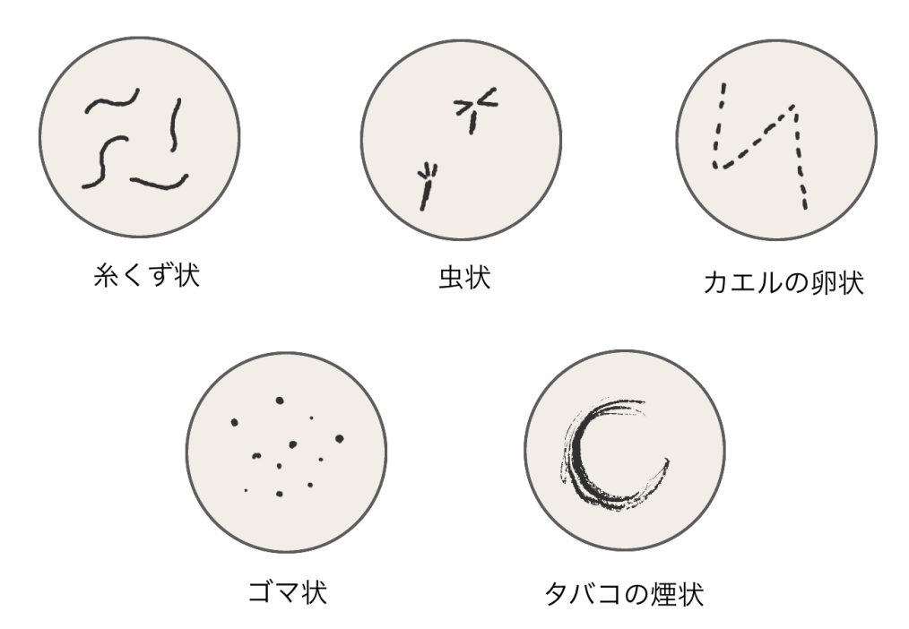 飛蚊症 - HOYA株式会社