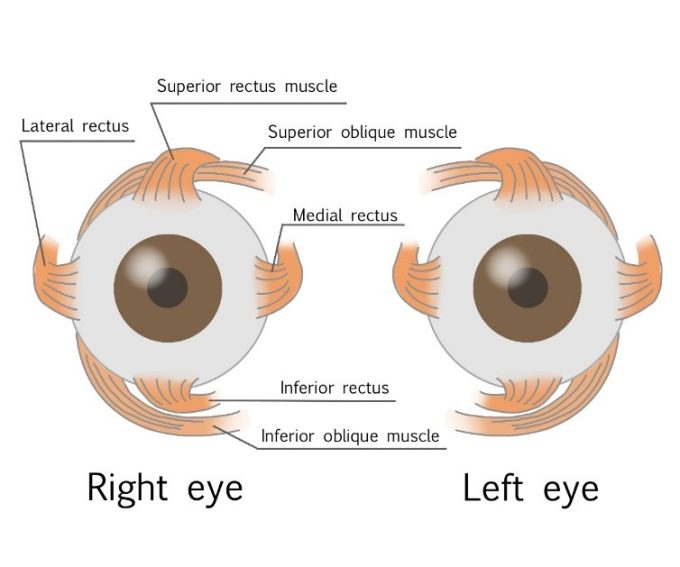 Strabismus - HOYA Corporation