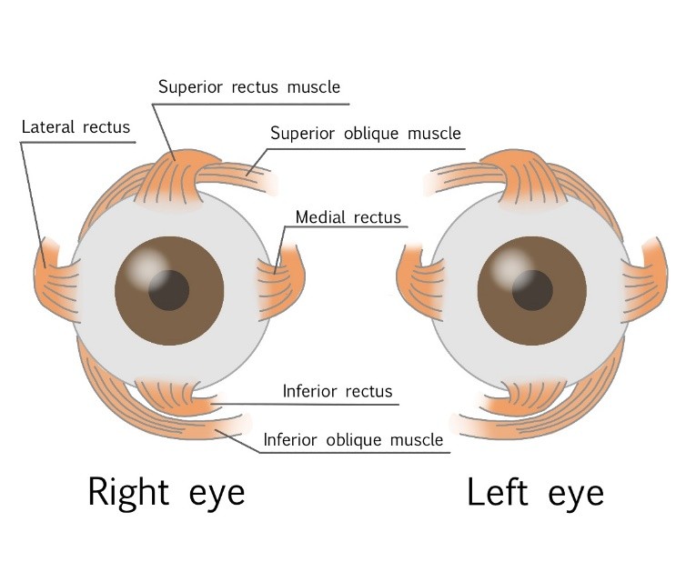 Strabismus - HOYA Corporation